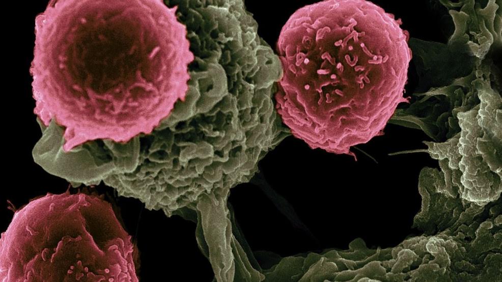 Cancer cluster concerns: a wife's fight to get answers | WPEC